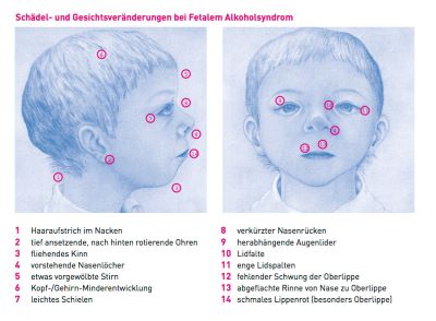FASD-OKAY Selbsthilfegruppe – FASD-OKAY Selbsthilfegruppe